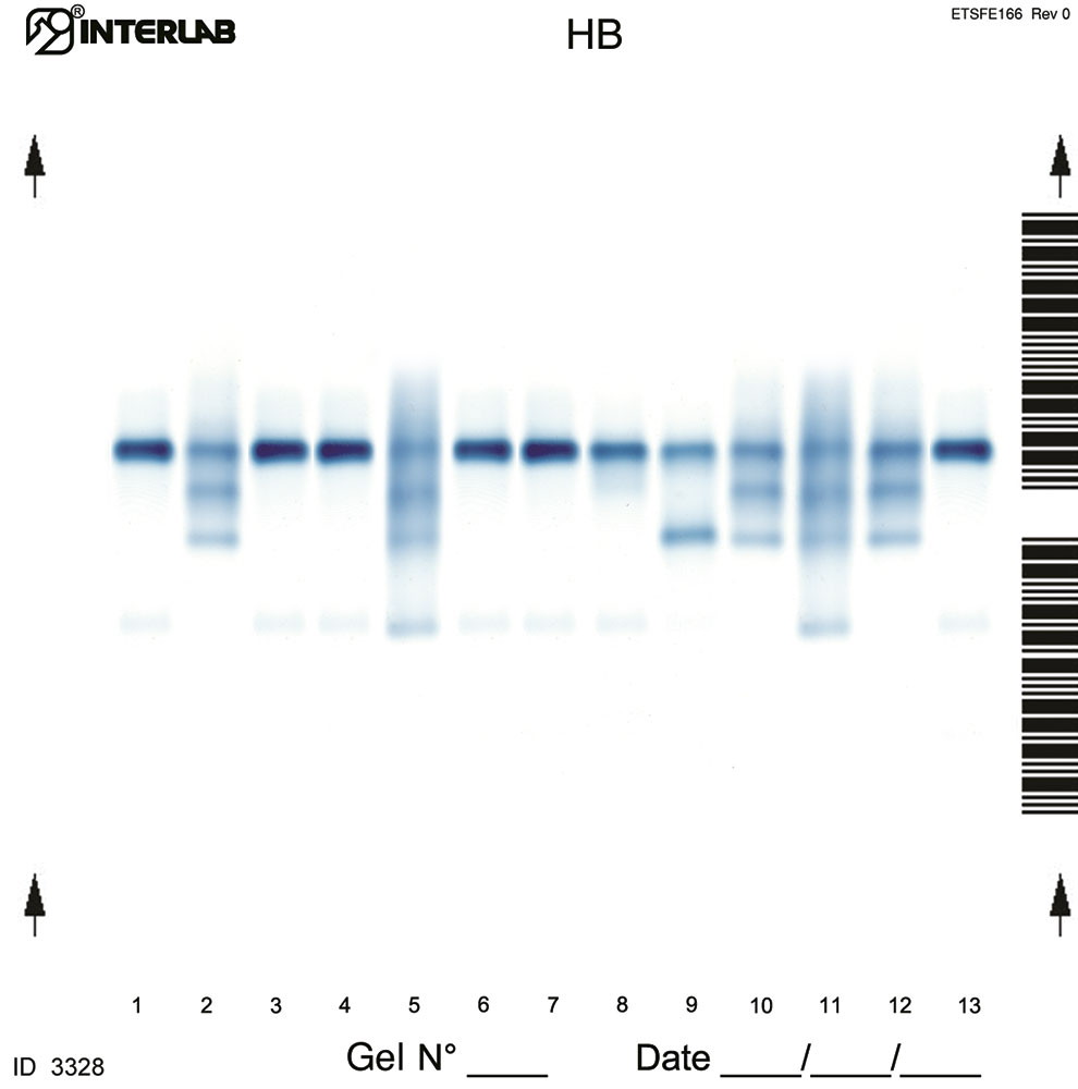 دستگاه Interlab Pretty